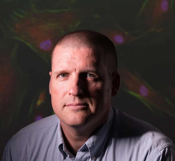 Research Offers New Insight for Treating Aggressive Form of Breast ...